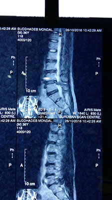 Dr. Saikat Sarkar - Orthopaedic Spine Surgeon