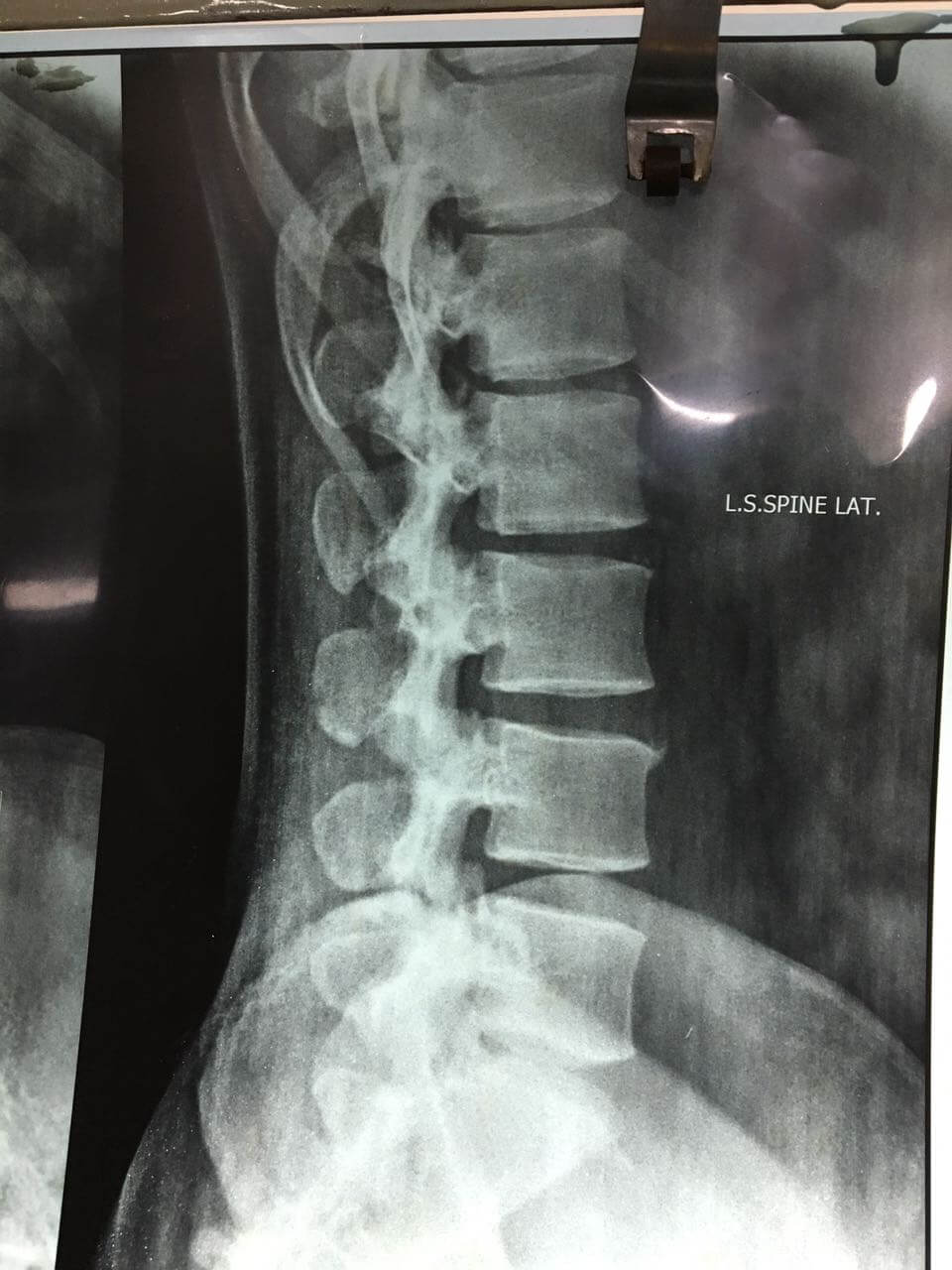 Dr. Saikat Sarkar - Orthopaedic Spine Surgeon